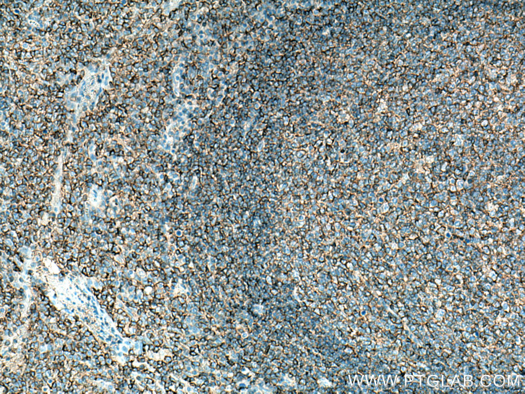 HLA class I ABC Antibody 15240-1-AP | Proteintech