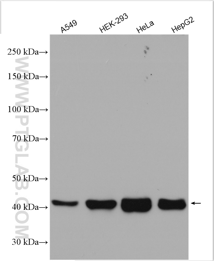 HLA class I ABC antibody (15240-1-AP) | Proteintech | 武汉三鹰生物技术有限公司