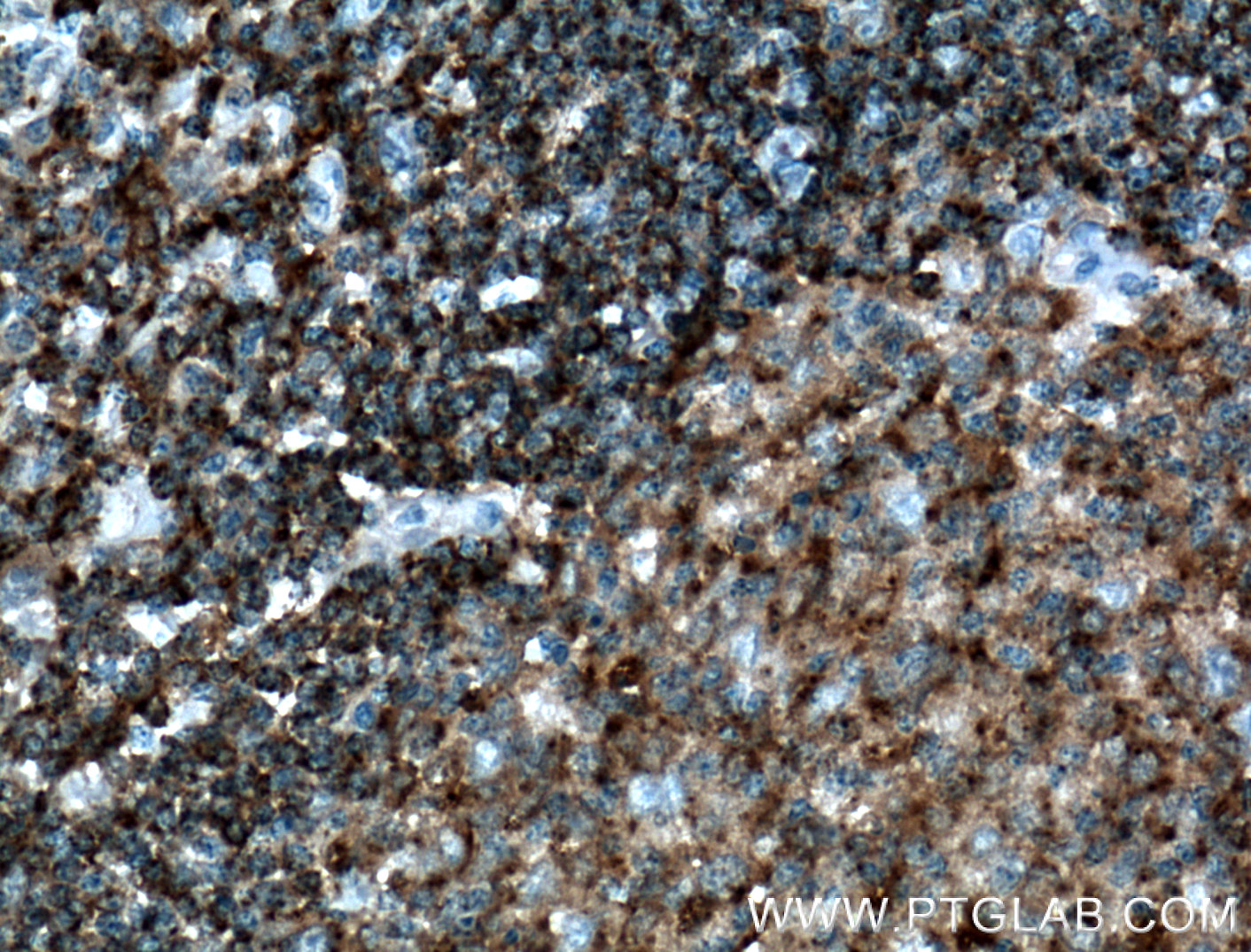 HLA-DMB antibody (21704-1-AP) | Proteintech | 武汉三鹰生物技术有限公司 HLA-DMB antibody (21704-1-AP) | Proteintech | 武汉三鹰生物技术有限公司