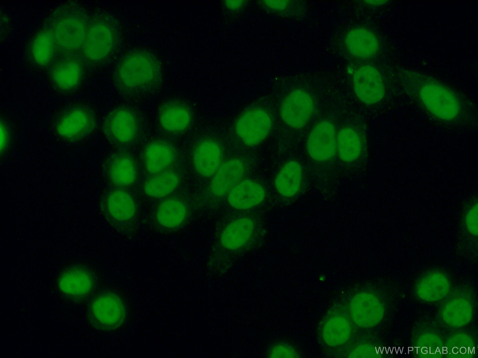 HNRNPU antibody (16365-1-AP) | Proteintech | 武汉三鹰生物技术有限公司