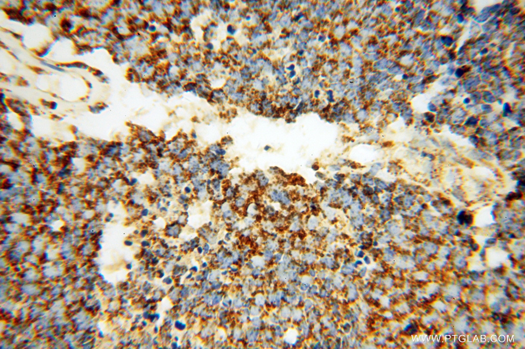 HSP60 Antibody 15282-1-AP | Proteintech