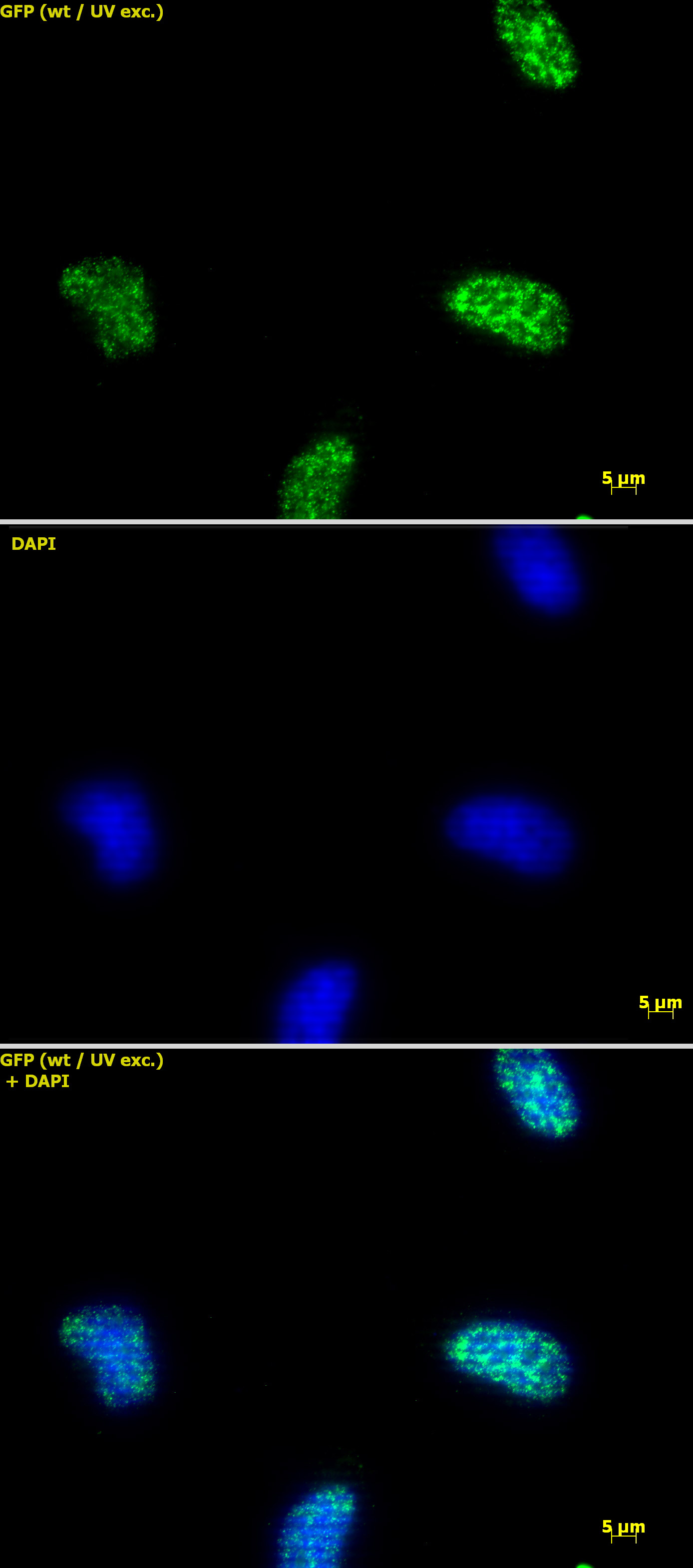 Histone H3K9ac antibody (pAb) | Proteintech | 武汉三鹰生物技术有限公司
