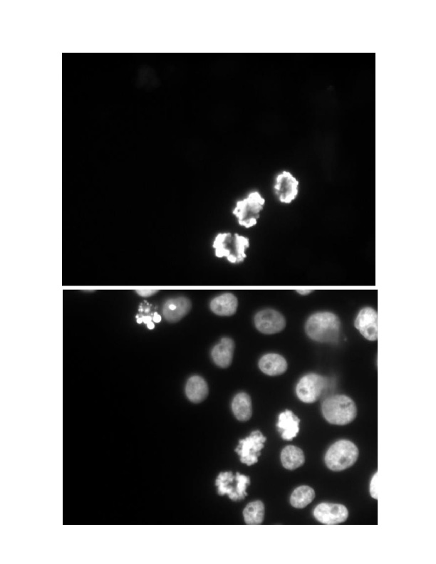 Histone H3S10ph antibody (mAb) (Clone 6G8B7) | Proteintech | 武汉三鹰生物技术有限公司