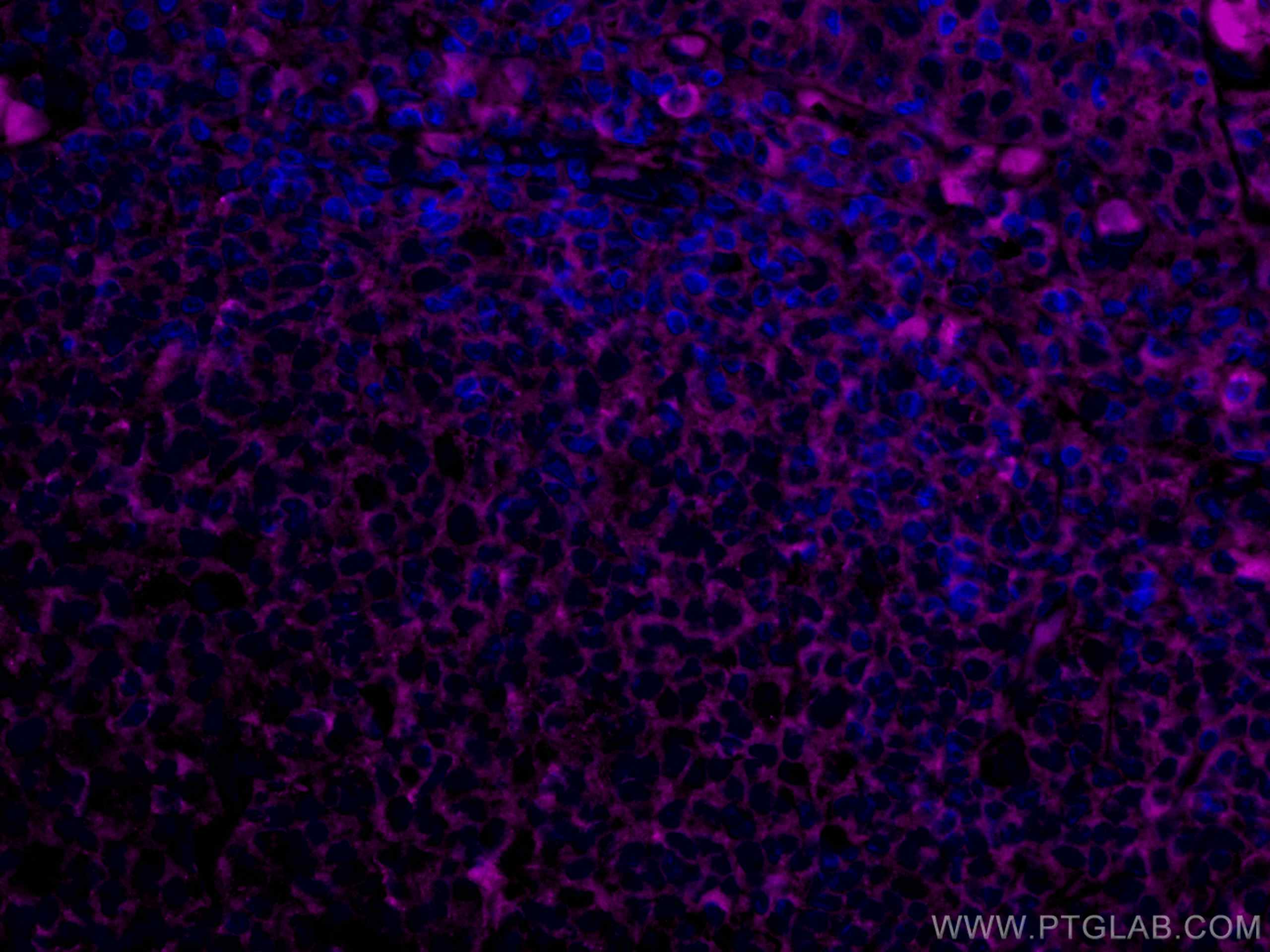 Human IgG Kappa chain antibody (CL647-67761) | Proteintech