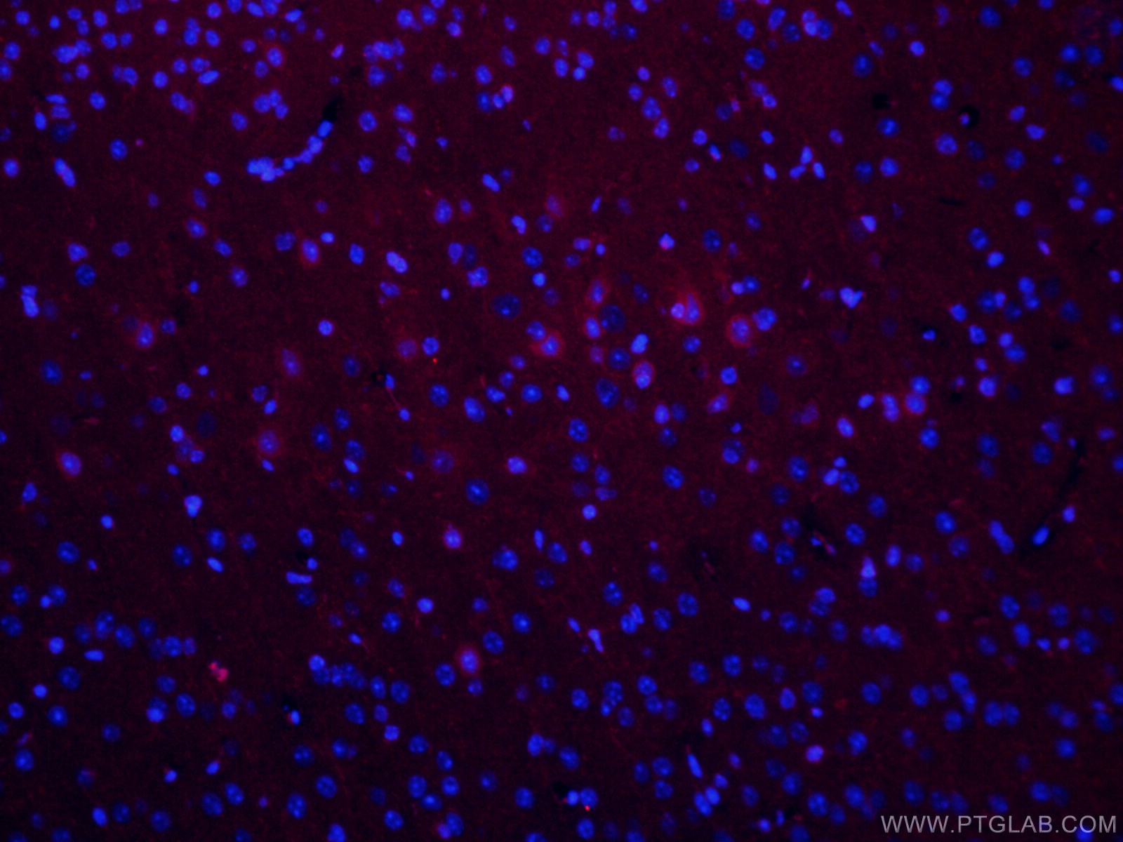 IBA1 antibody (CL594-66827) | Proteintech | 武汉三鹰生物技术有限公司