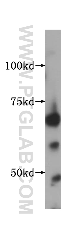 IGF2BP2 Antibody 11601-1-AP | Proteintech