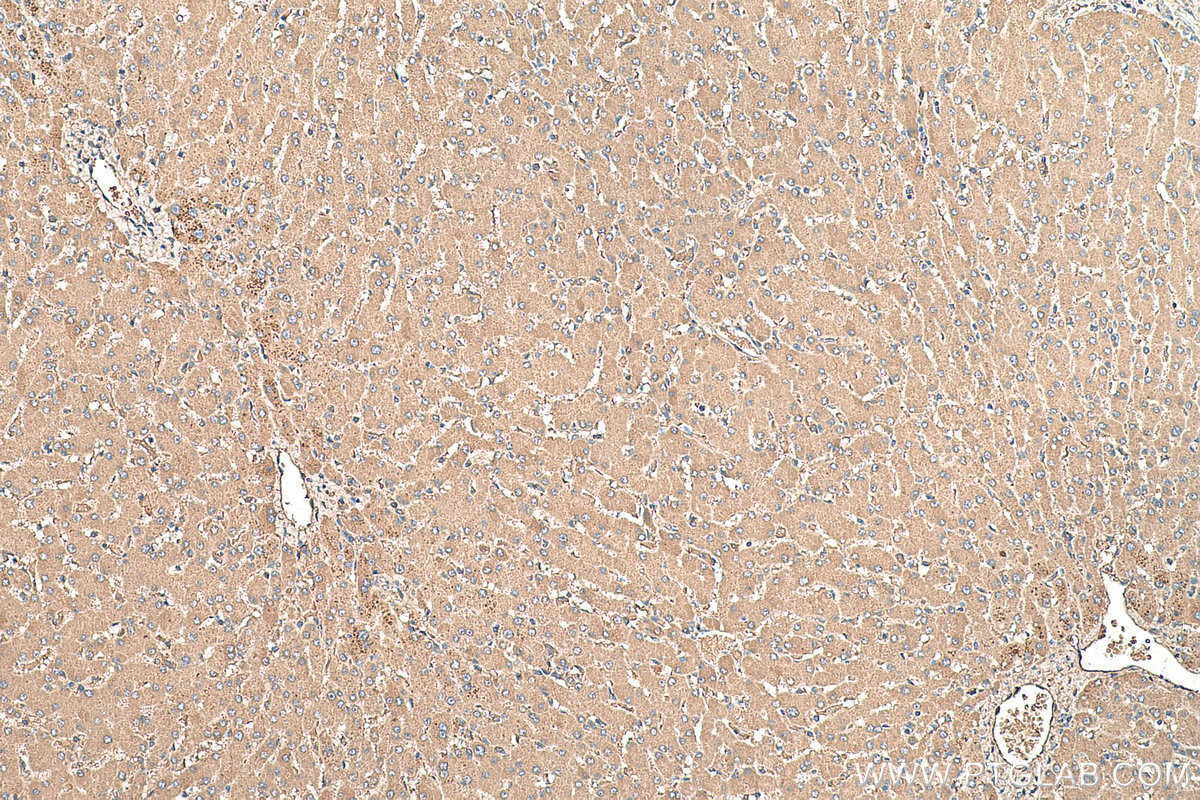 IHCeasy AFP Ready-To-Use IHC Kit KHC0380 | Proteintech | 武汉三鹰生物技术有限公司
