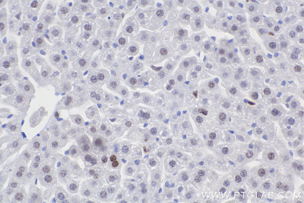 IHCeasy Phospho-Histone H2A.X (Ser139) Ready-To-Use IHC Kit KHC2276 ...