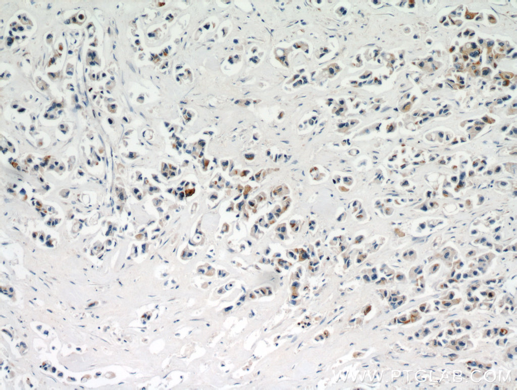 IL-17RB Antibody 20673-1-AP | Proteintech