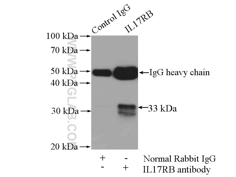 IL-17RB Antibody 20673-1-AP | Proteintech
