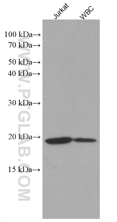 IL-2 antibody (60306-1-Ig) | Proteintech | 武汉三鹰生物技术有限公司