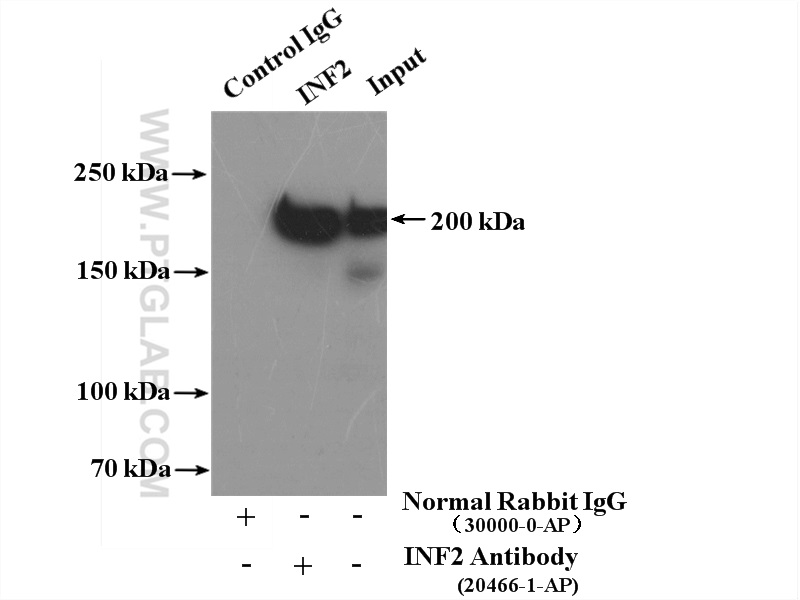 INF2 antibody (20466-1-AP) | Proteintech | 武汉三鹰生物技术有限公司
