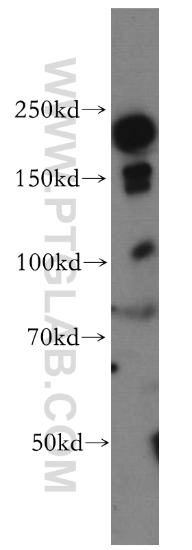 INF2 Antibody 20466-1-AP | Proteintech