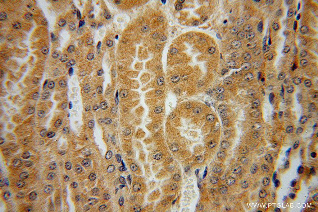 Inhibin Beta B Antibody 17577-1-AP | Proteintech