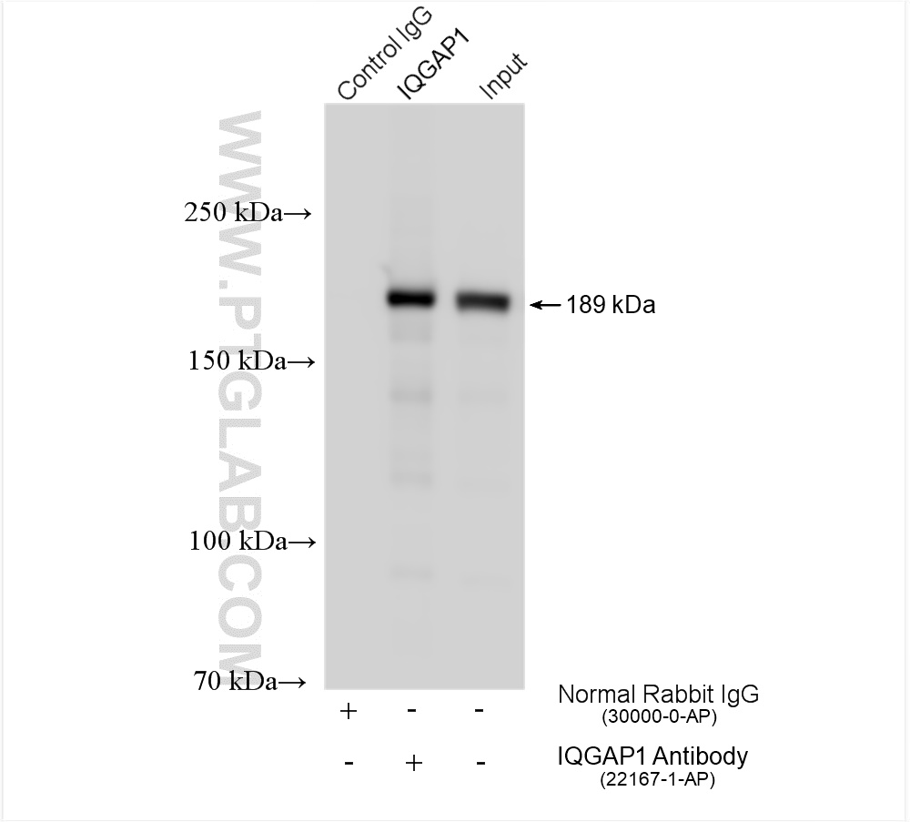IQGAP1 antibody (22167-1-AP) | Proteintech | 武汉三鹰生物技术有限公司