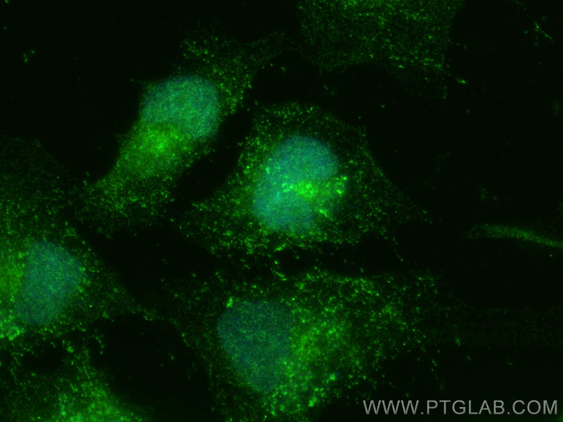 IRF3 antibody (11312-1-AP) | Proteintech | 武汉三鹰生物技术有限公司
