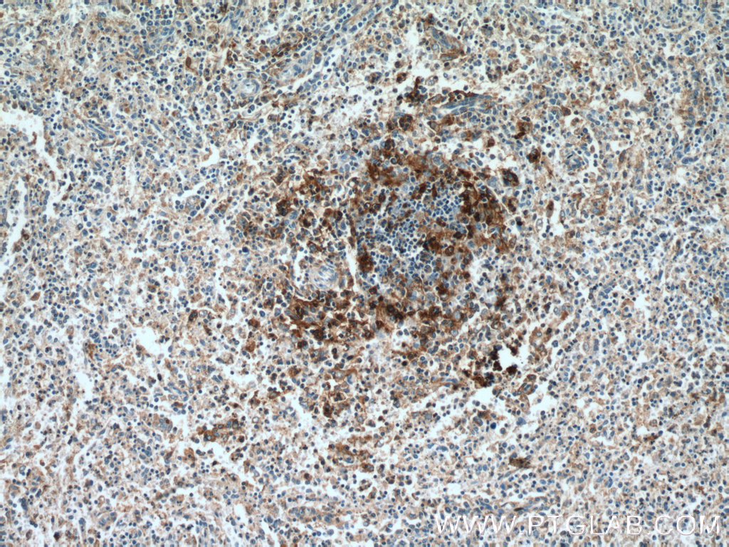 CD11c/Integrin Alpha X antibody (17342-1-AP) | Proteintech | 武汉三鹰生物技术有限公司