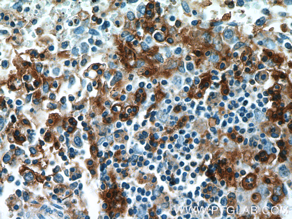 CD11c/Integrin Alpha X antibody (17342-1-AP) | Proteintech | 武汉三鹰生物技术有限公司