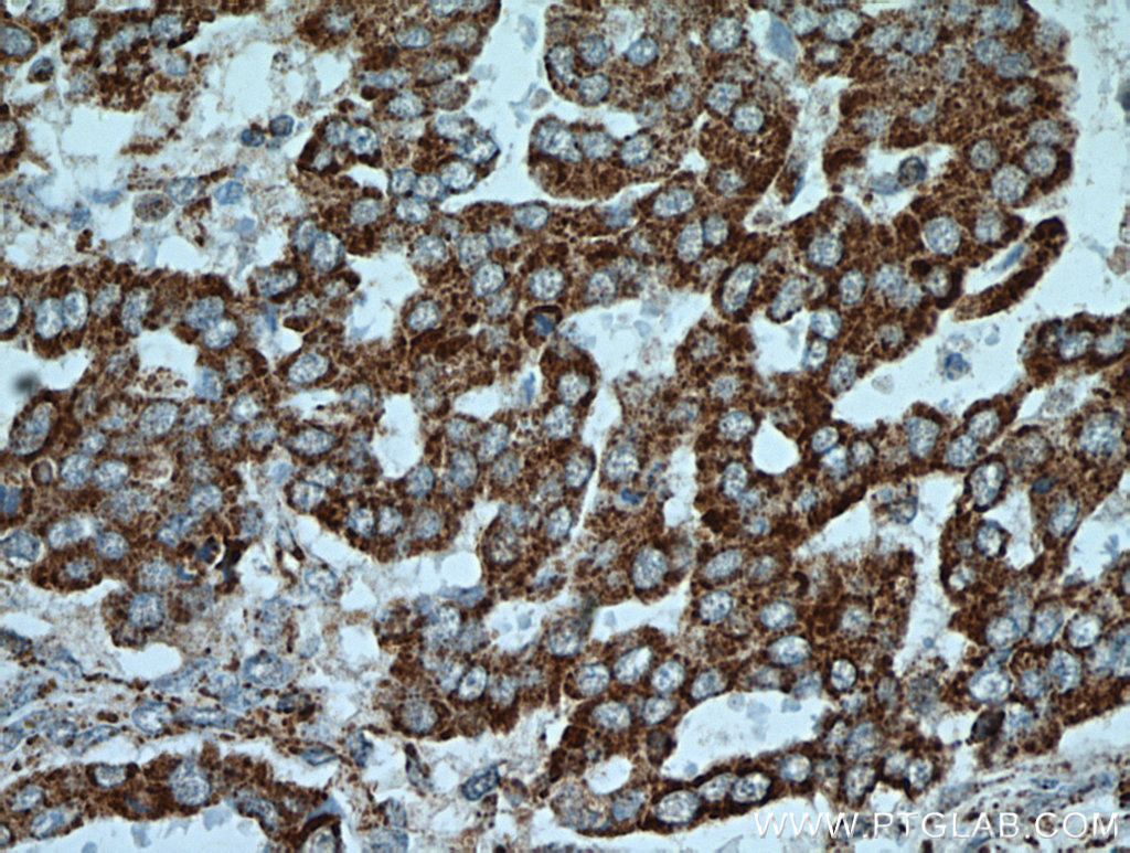 Integrin beta-6 Antibody 21703-1-AP | Proteintech