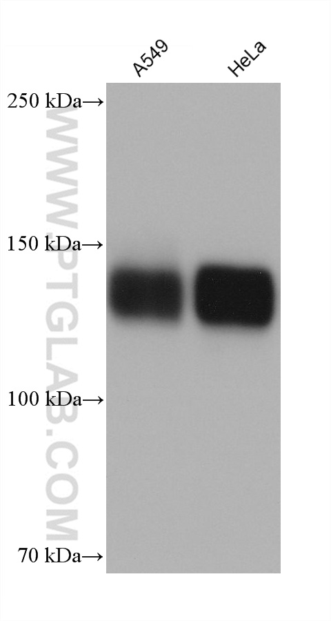 Integrin alpha-5 antibody (68561-1-Ig) | Proteintech | 武汉三鹰生物技术有限公司