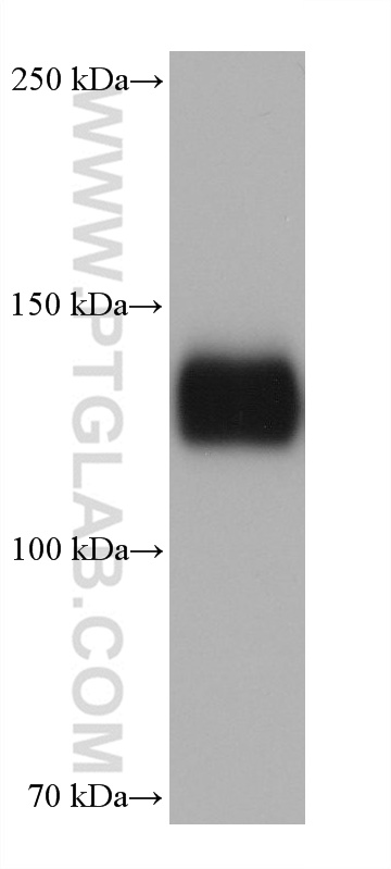 Integrin alpha-5 antibody (68561-1-Ig) | Proteintech | 武汉三鹰生物技术有限公司