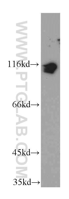 KDM1 antibody (20813-1-AP) | Proteintech