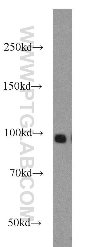 KDM1 antibody (20813-1-AP) | Proteintech