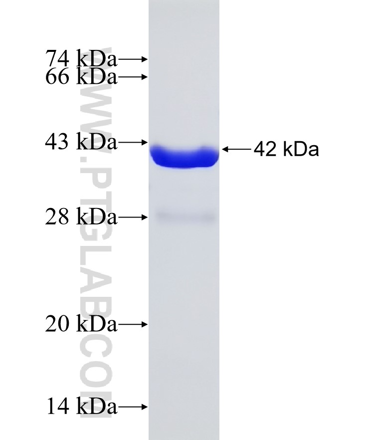 KRT10 Fusion Protein Ag32344 | Proteintech | 武汉三鹰生物技术有限公司