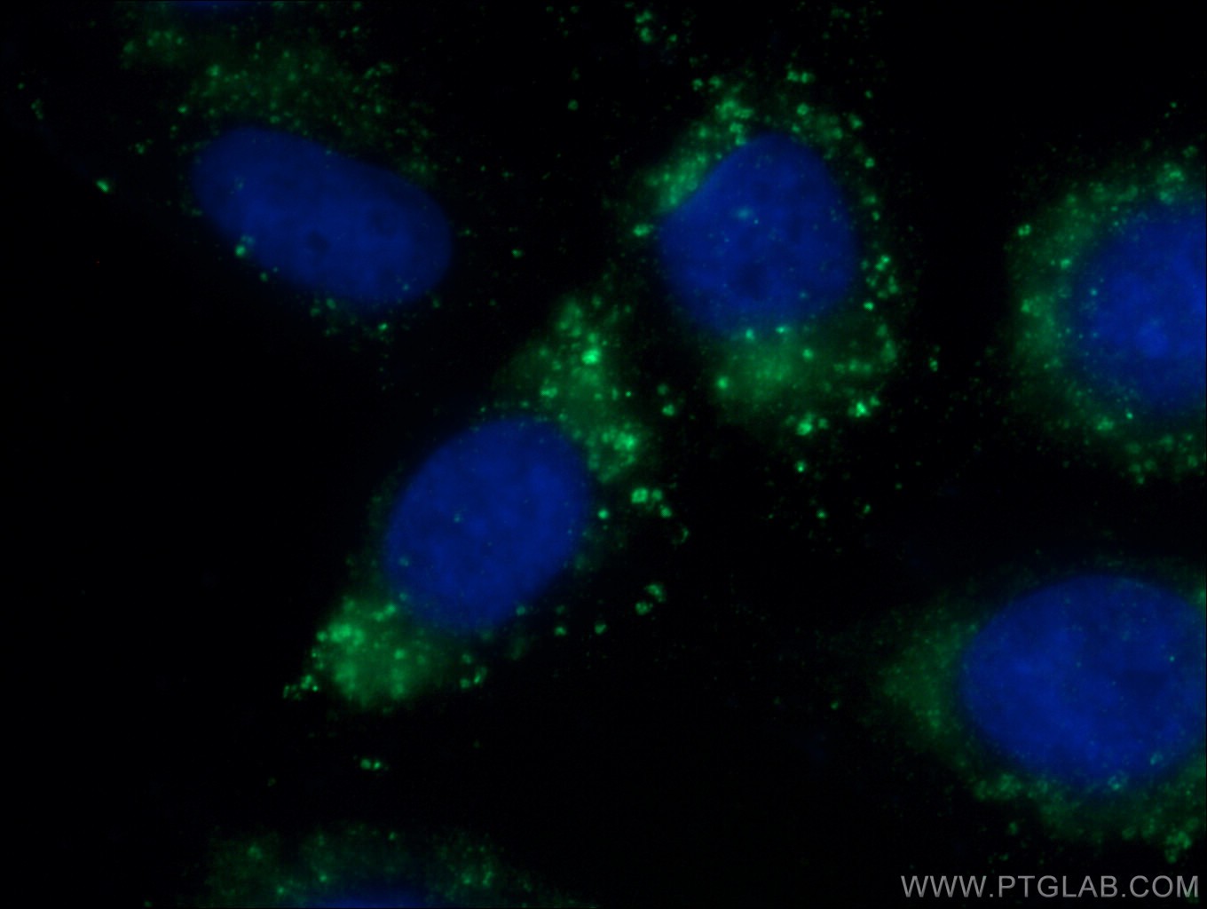 LAMP2 antibody (10397-1-AP) | Proteintech