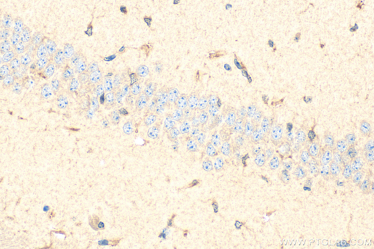 LCAT antibody (33293-1-AP) | Proteintech | 武汉三鹰生物技术有限公司