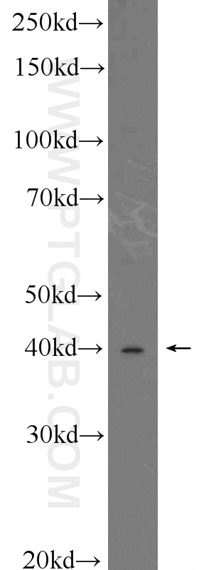 LEF1 Antibody 14972-1-AP | Proteintech