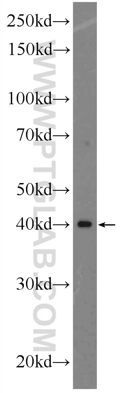 LEF1 Antibody 14972-1-AP | Proteintech