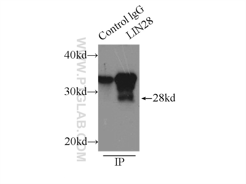 LIN28 antibody (11724-1-AP) | Proteintech | 武汉三鹰生物技术有限公司