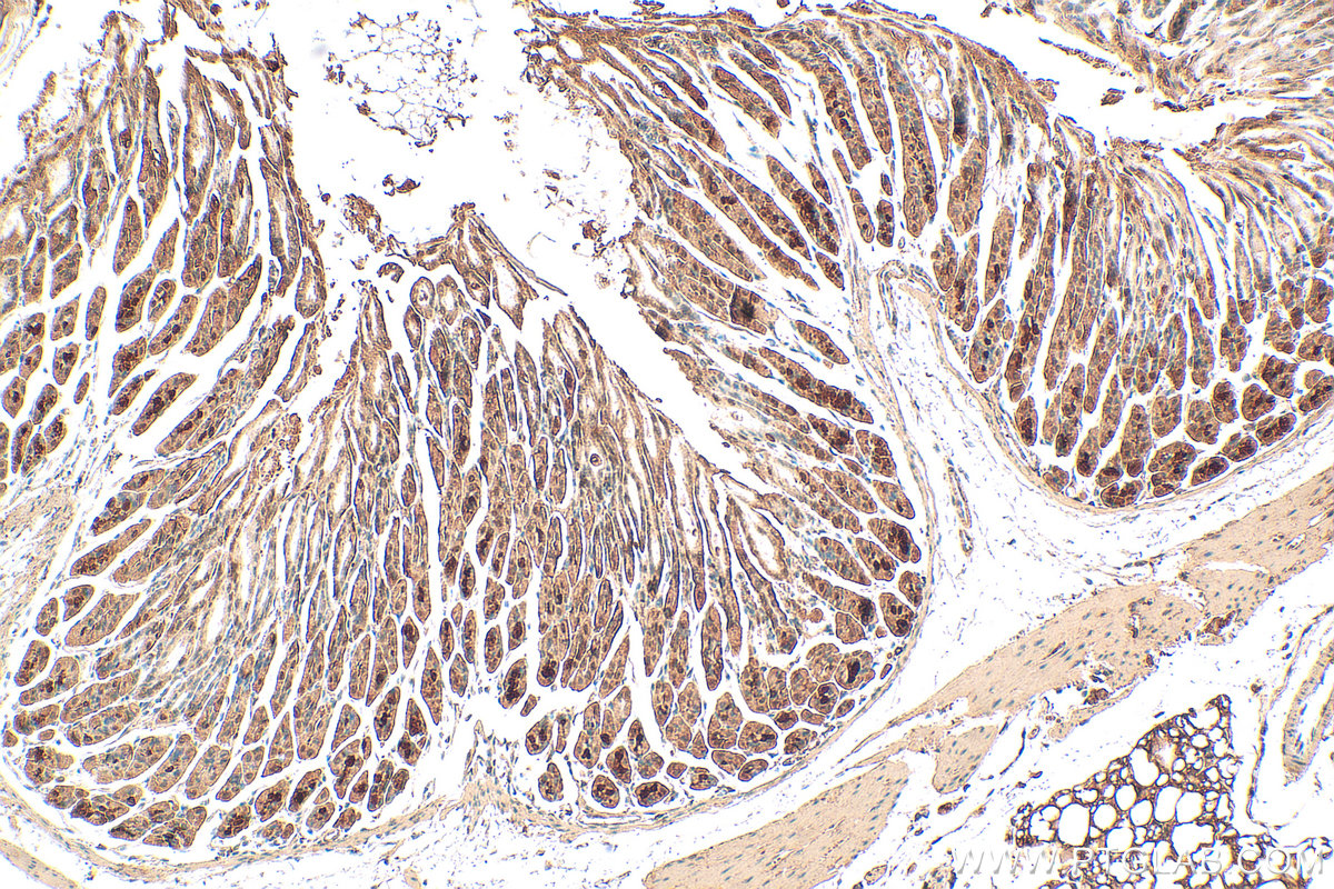 LRMDA antibody (31001-1-AP) | Proteintech | 武汉三鹰生物技术有限公司