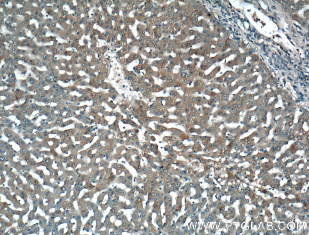 LSR antibody (18216-1-AP) | Proteintech | 武汉三鹰生物技术有限公司