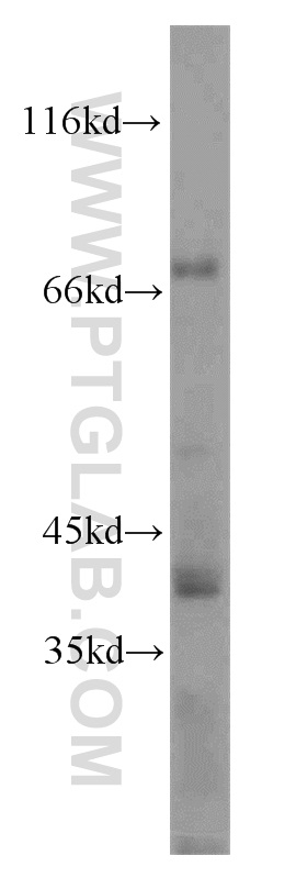 LSR antibody (18216-1-AP) | Proteintech