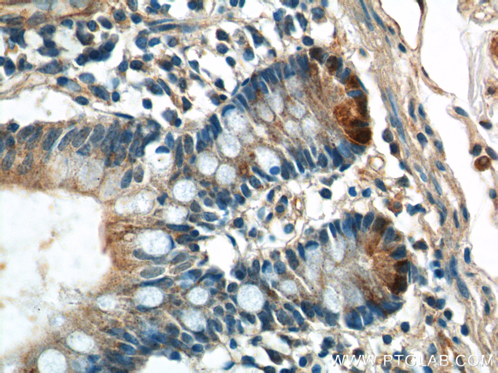 LGR5 antibody (21833-1-AP) | Proteintech | 武汉三鹰生物技术有限公司