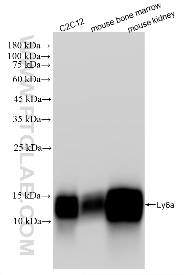 Ly-6A/E (Sca-1) antibody (87403-1-RR) | Proteintech | 武汉三鹰生物技术有限公司