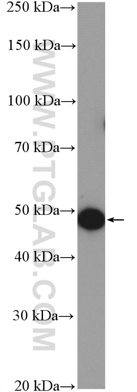 TIP47 antibody (10694-1-AP) | Proteintech | 武汉三鹰生物技术有限公司