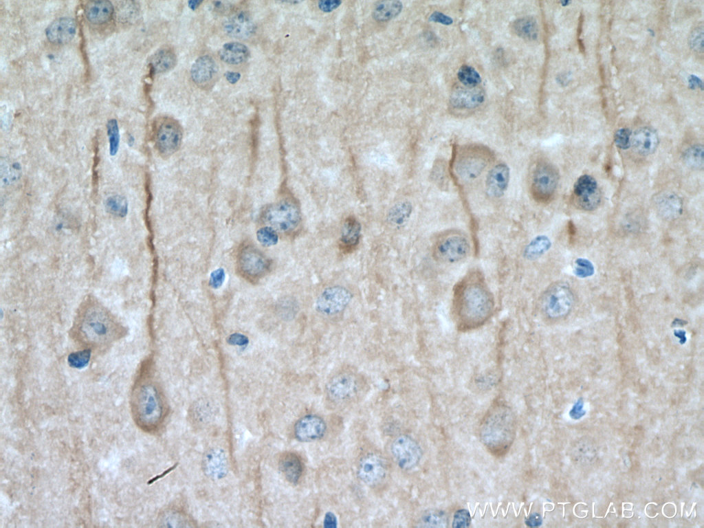 LC3 Antibody 14600-1-AP | Proteintech