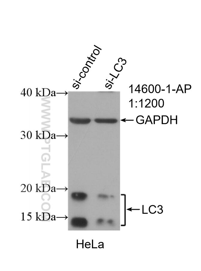 LC3 Antibody 14600-1-AP | Proteintech