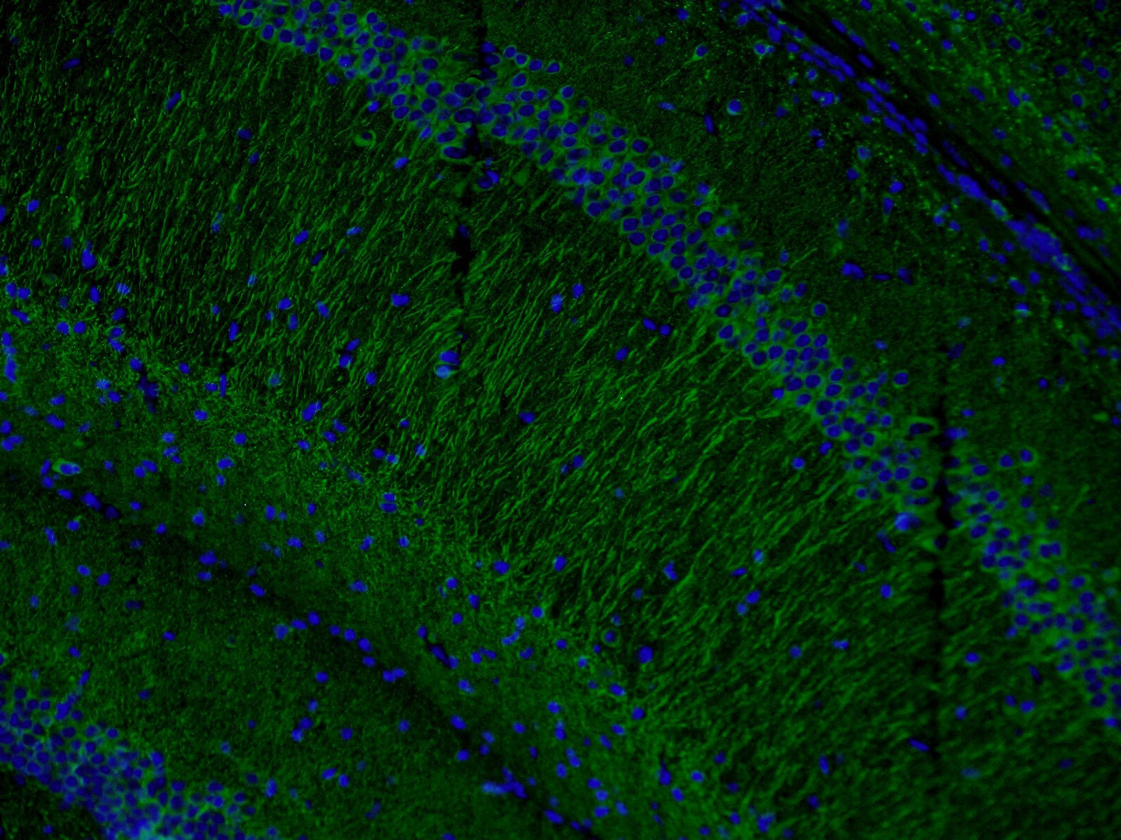 MAP2 Antibody 17490-1-AP | Proteintech