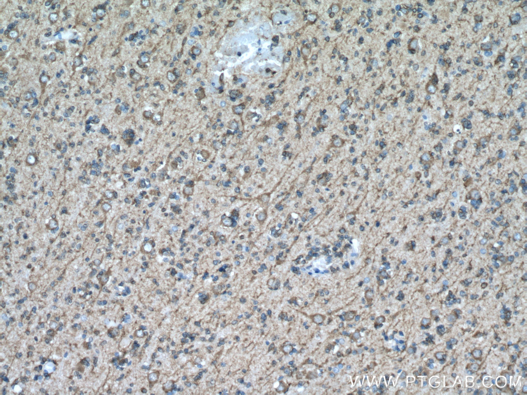 MAP2 antibody (17490-1-AP) | Proteintech | 武汉三鹰生物技术有限公司