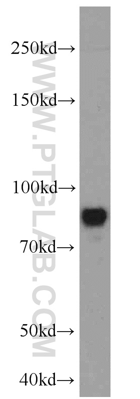 MAP2 antibody (17490-1-AP) | Proteintech | 武汉三鹰生物技术有限公司