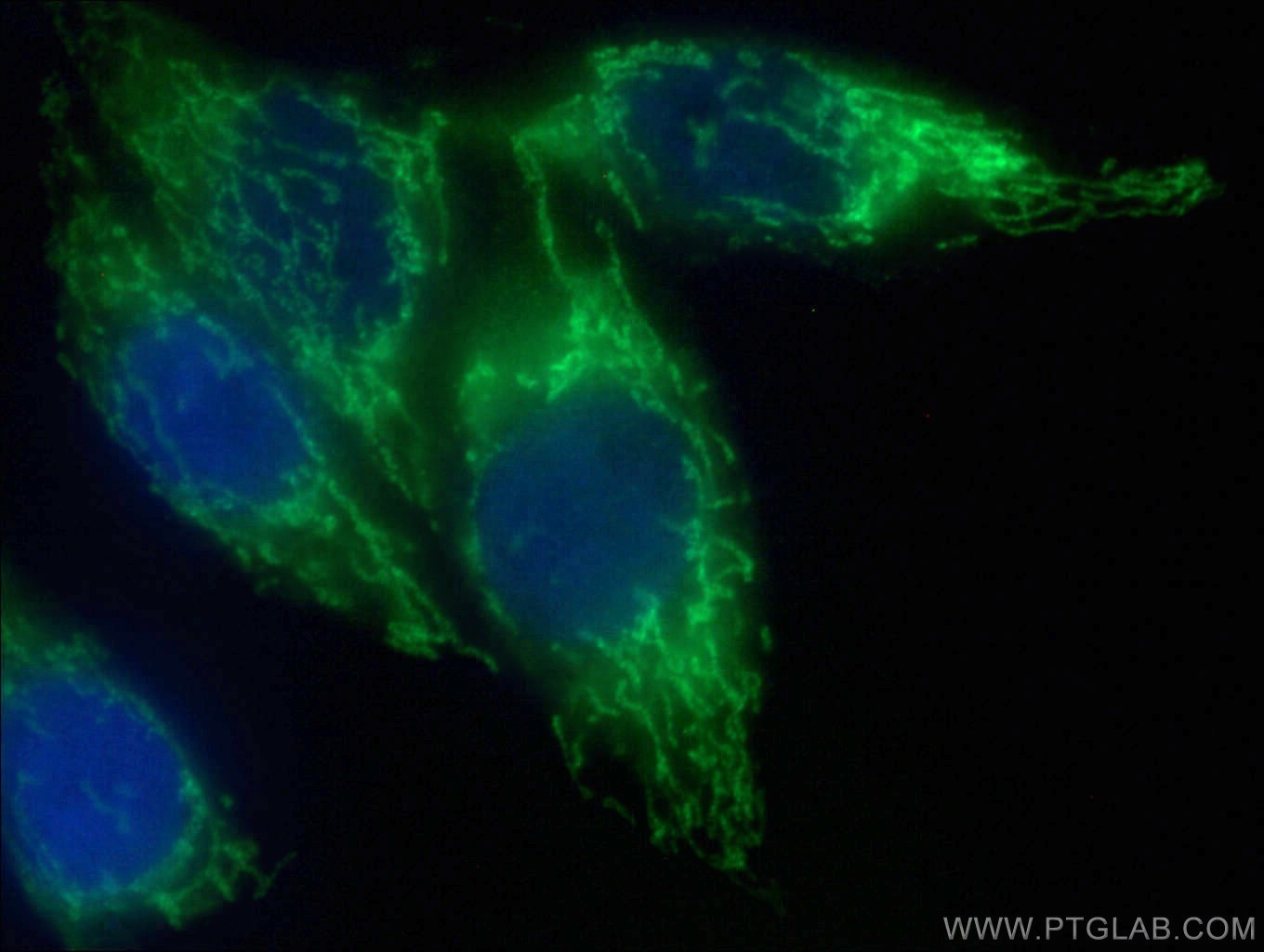 MAVS; VISA Antibody 14341-1-AP | Proteintech