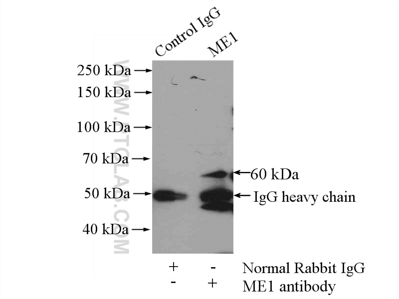 ME1 antibody (16619-1-AP) | Proteintech | 武汉三鹰生物技术有限公司