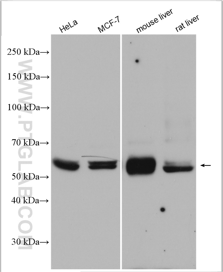 ME1 antibody (16619-1-AP) | Proteintech | 武汉三鹰生物技术有限公司