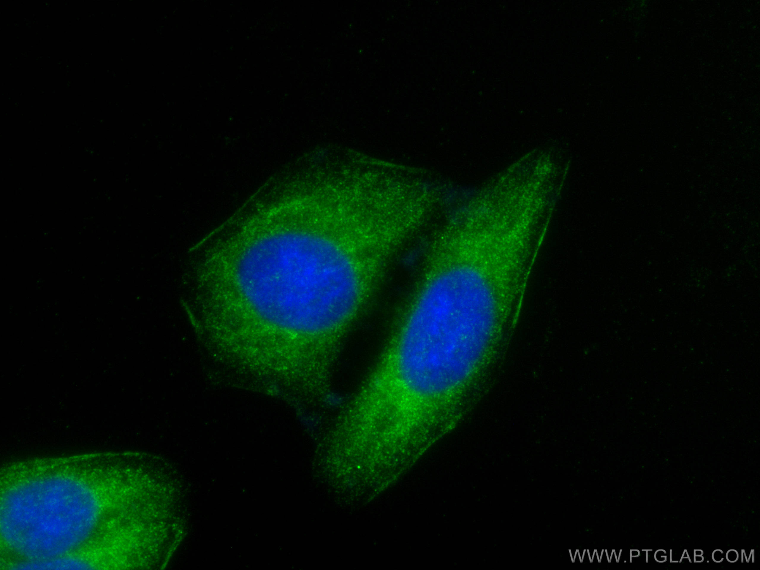 MEF2C antibody (10056-1-AP) | Proteintech | 武汉三鹰生物技术有限公司