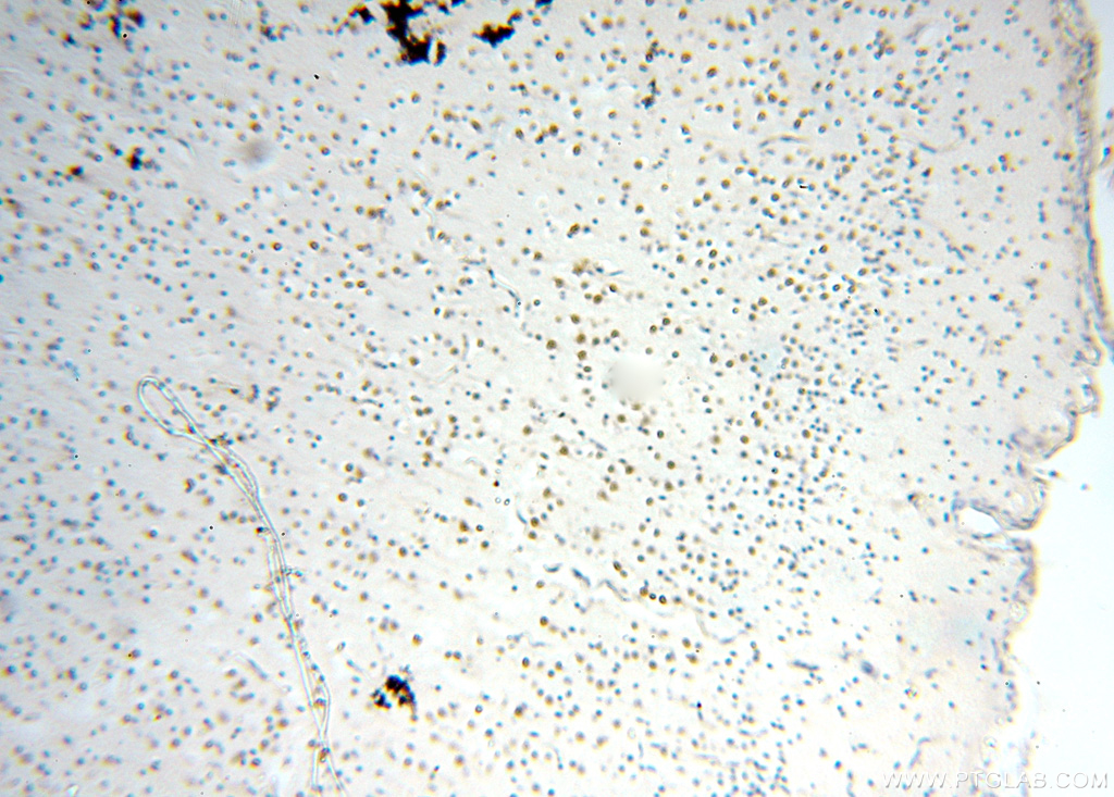 MEF2C antibody (18290-1-AP) | Proteintech | 武汉三鹰生物技术有限公司