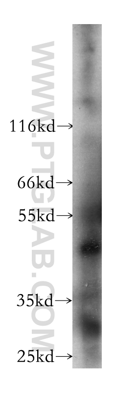 MEF2C antibody (60124-1-Ig) | Proteintech | 武汉三鹰生物技术有限公司
